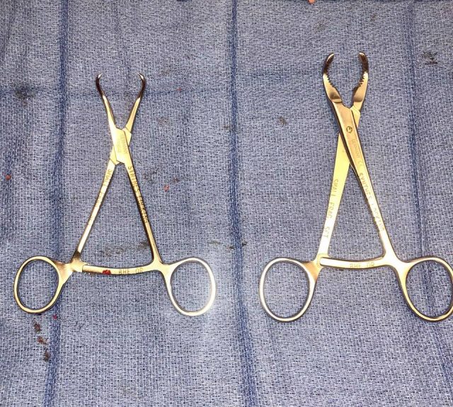 Reducing a Fracture in the Operating Room - The Orthopaedic Specialists