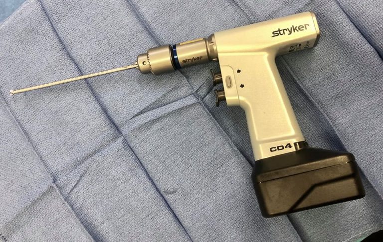 How Screws Are Used in Orthopaedic Surgeries - Orthopaedic Specialists